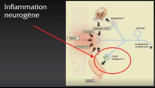 Formation – Douleur – Académie de Kinésiologie du Québec